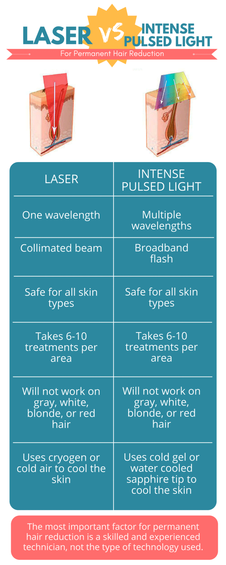 Treatment comparison: the difference between Laser Hair Removal and IPL